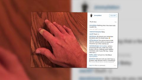 Jimmy Fallon Falls and Injures Another Finger