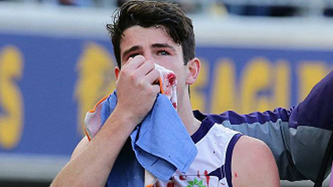 Shocking punch rocks AFL