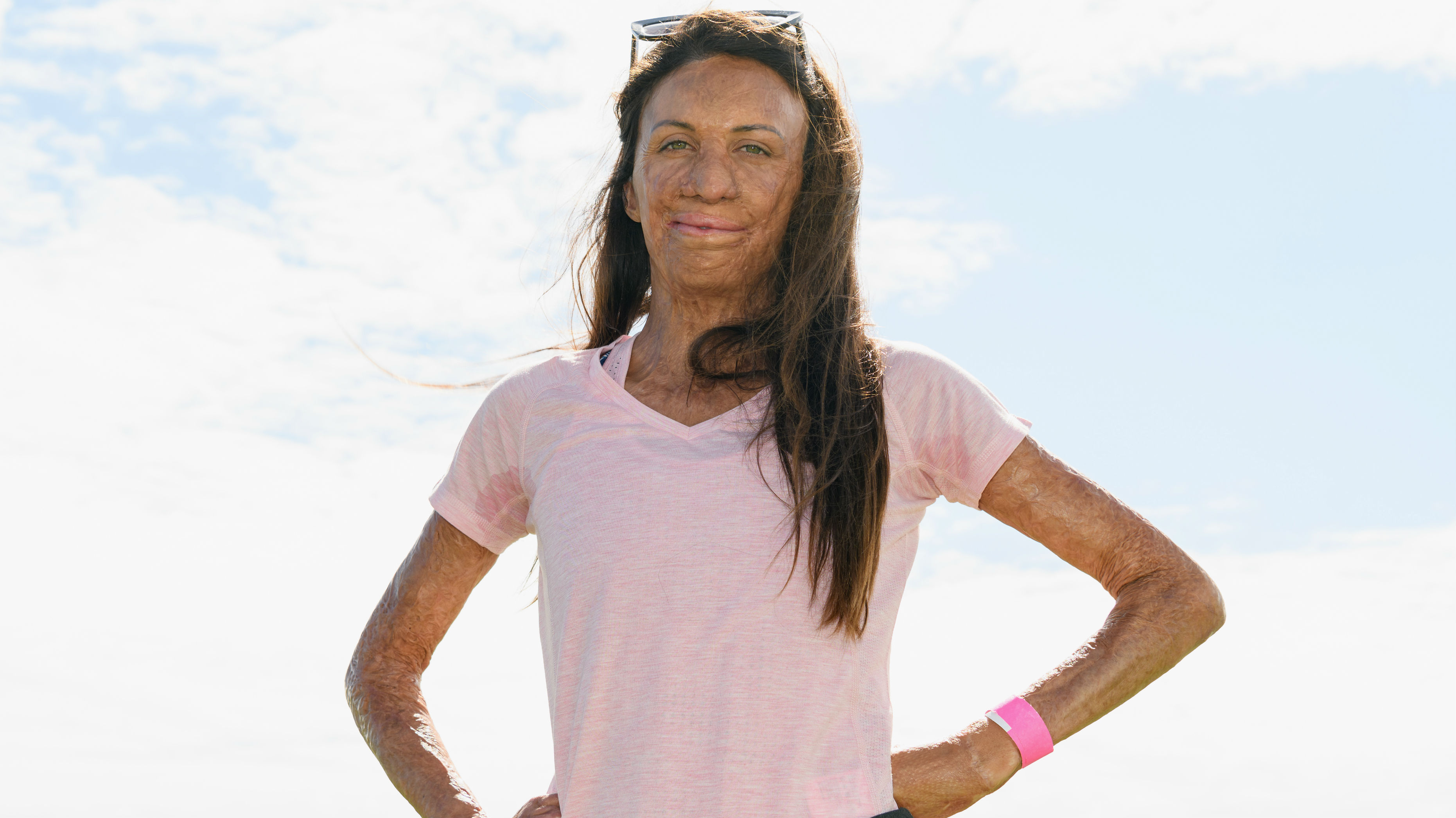 Turia Pitt talks her new book and life lessons for teens